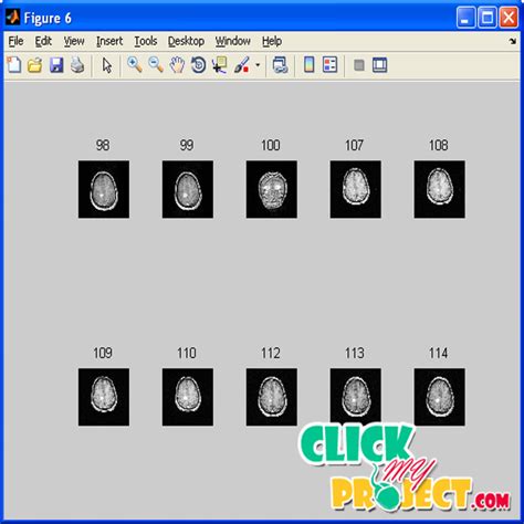 Content Based Microscopic Image Retrieval System For Multi Image