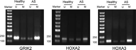 Frontiers Bioinformatic Analysis And Experimental Validation Identified Dna Methylation