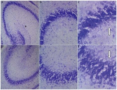 Nissl Staining