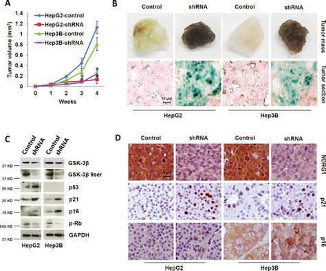 Ndrg1 Suppression Activates Senescence In Hcc Cells In Vivo A Growth
