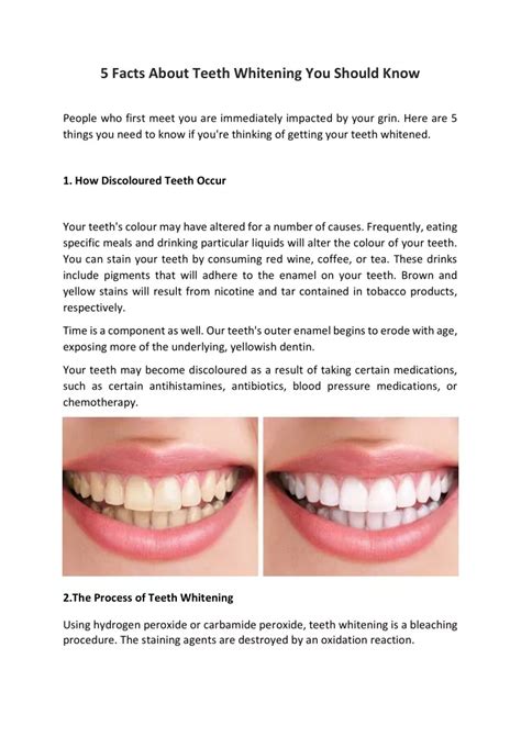 Ppt 5 Facts About Teeth Whitening You Should Know Powerpoint