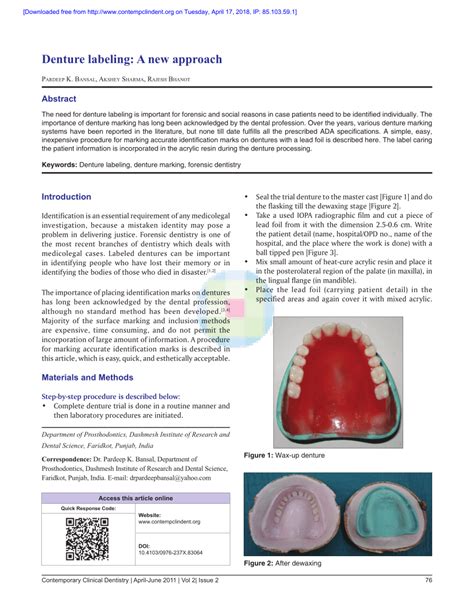 Indenture Denture Marking System At Carlos Atwood Blog
