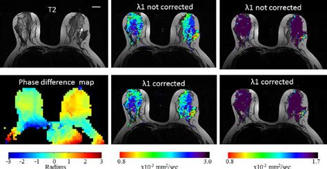 Example Of Geometric Distortion Correction Using A Phase Difference Download Scientific Diagram