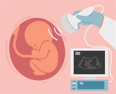 15500 Ultrasound Stock Illustrations Royalty Free Vector Graphics