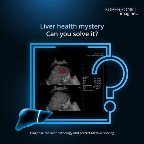Pietro Ticci On Linkedin The Metavir Scoring System Evaluates Liver Fibrosis And Inflammation In…
