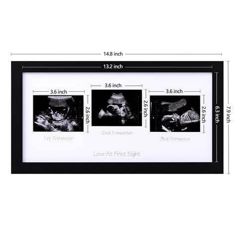 Snapklik Eletecpro Triple Ultrasound Picture Frame Display 34