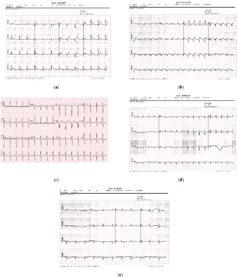 Figure 2 From A Robust Framework Combining Image Processing And Deep