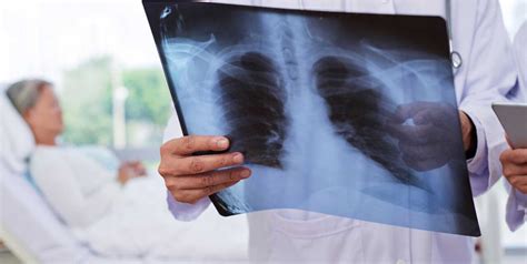 Cursos para afrontar la pandemia de COVID 19 Radiología e Imagen