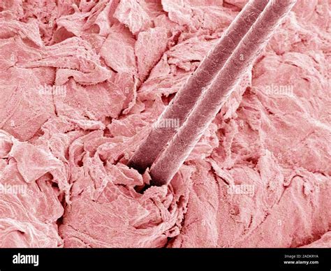 Human Hair Coloured Scanning Electron Micrograph Sem Of Human Hairs Emerging From The