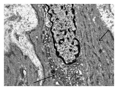 Ultrastructural Features Of Phenotypic Transformation This Download Scientific Diagram