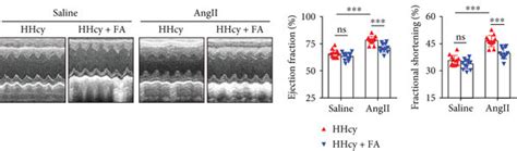 FA Supplement Attenuated HHcy Aggravated Cardiac Hypertrophy In Mice