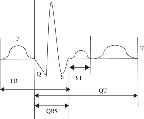 Schematic Diagram Of P Wave Duration P Represents The Exciting Process