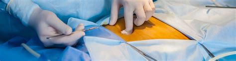 Hernia Mesh Lawyers Los Angeles Best Lawyer For Hernia Mesh Lawsuit