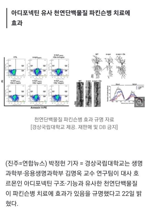 경상국립대 김명옥 교수 파킨슨병 치료제 새 길 열었다 인스티즈 Instiz 이슈 카테고리