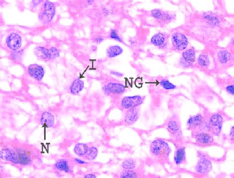Photomicrograph Of Pineal Gland Group I Showing Parenchyma Which