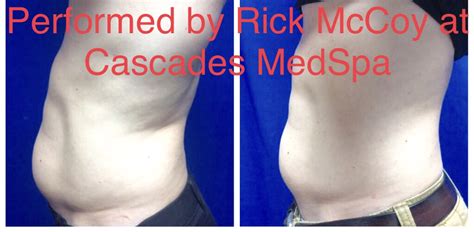 Photos Cascades Medspa Orlando Florida