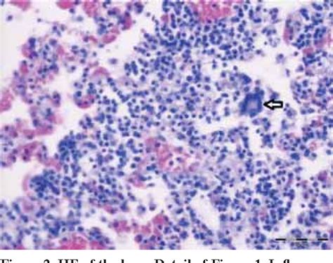 Figure 2 From Morganella Morganii Geassocieerde Broncho Interstitiële