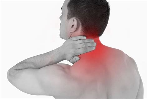 Ano Ang Gamot Sa Pananakit Ng Leeg O Stiff Neck Mediko PH