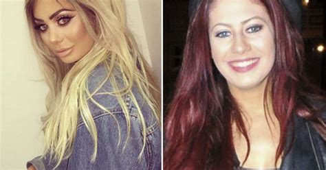Geordie Shores Chloe Ferry Claims She Was Ugly Before Surgery