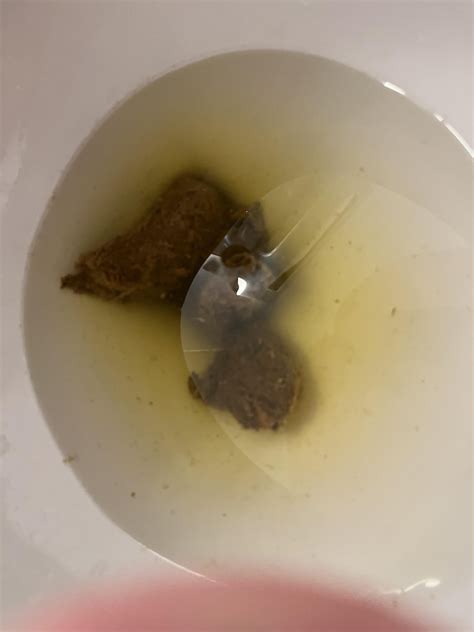 Whats Going On With These Poops Stringyundigested Bits Rpoop