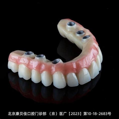 种牙与镶牙有什么区别哪个好一些 知乎