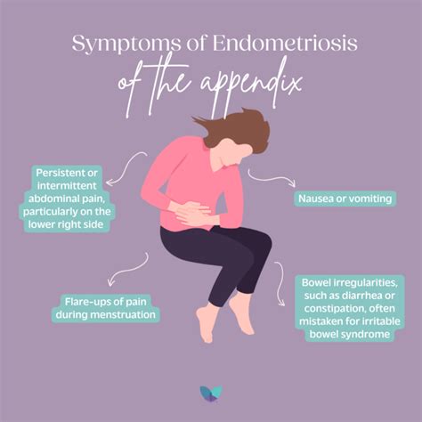 Can Endometriosis Affect Your Appendix Symptoms And Treatment Insights Pelvic Rehabilitation