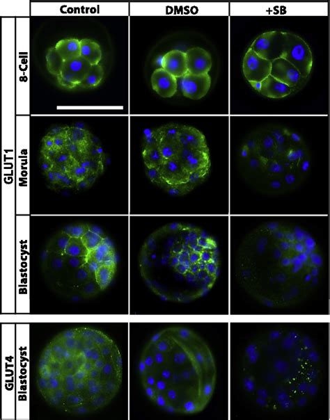 Table 1 From The P38 Mapk Signalling Pathway Is Required For Glucose