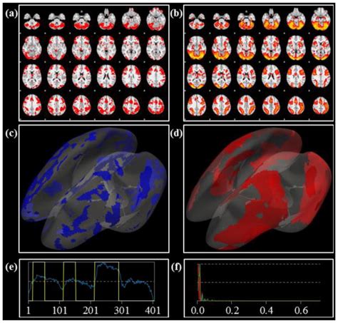 characterizing and differentiating task based and resting state fmri