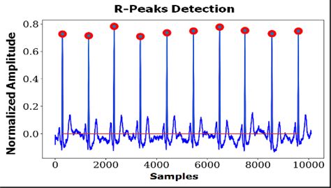 An Ecg Trace With Its R Peaks Detected Download Scientific Diagram