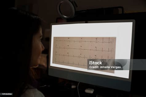 Electrocardiogram Shows Incomplete Right Bundle Branch Block Analyzed By Caucasian Cardiologist