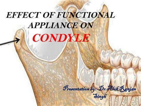 Condylar Growth I Orthodontics Seminar Pptx