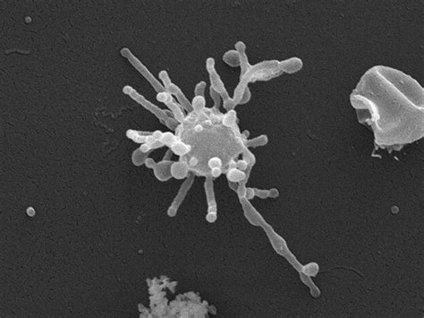 Des Chercheurs Dressent Le Portrait De Lancêtre Des Eucaryotes
