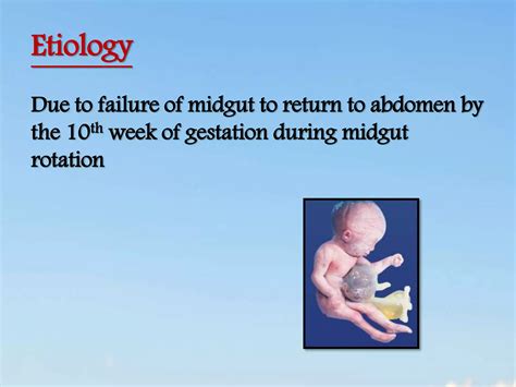 Abdominal Wall Defect Pptx