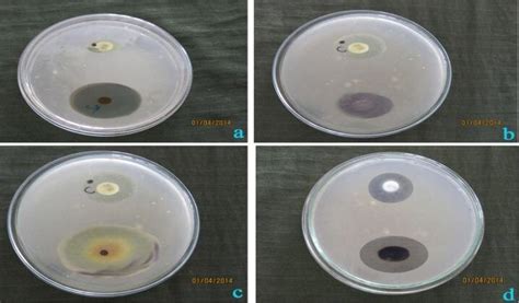 Photograph Showing Antibacterial Activity Of Silver Nanoparticles