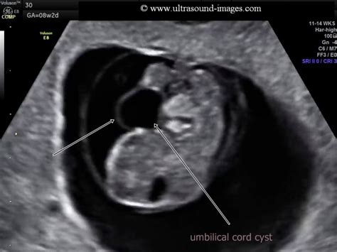 A Gallery Of High Resolution Ultrasound Color Doppler And 3d Images