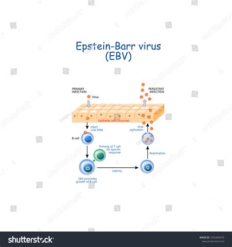 Mononucleosis Images Stock Photos Vectors Shutterstock