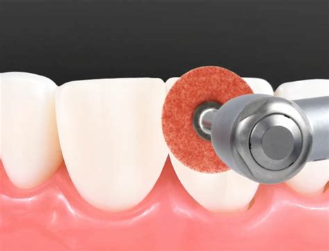 Bioclear Method Marc Schwartz DDS