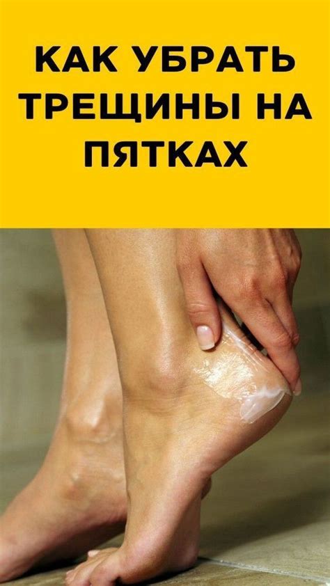 Как убрать трещины на пятках Natural Therapy Healthy Beauty Health