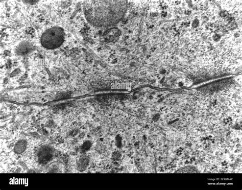 Transmission Electron Microscope TEM Micrograph Showing Three