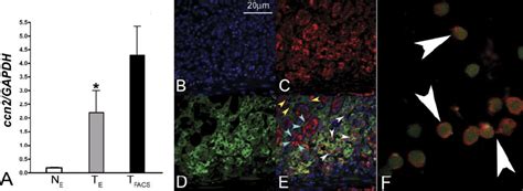 Ccn2 Expression In Tumor Ecl Cells A Ccn2 Transcript Was Detectable