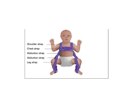 Developmental Dysplasia Of Hip Ddh Ppt
