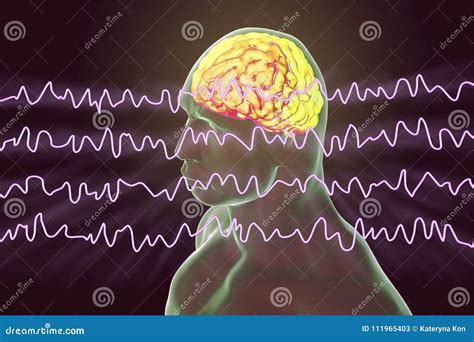 Eeg Cartoons Illustrations And Vector Stock Images 646 Pictures To Download From