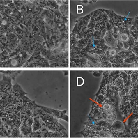 Effects Of Bpa Mehp And Their Combination On Hepg2 Cell Morphology A