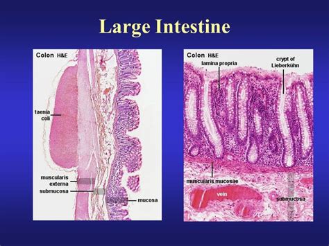23 Histology Large Intestine Ideas Large Intestine Intestines