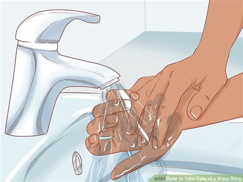 How To Take Care Of A Wasp Sting 14 Steps With Pictures