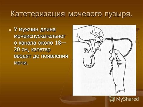 Презентация на тему: "Катетеризация мочевого пузыря. Уход за мочевым ...