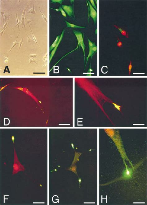 In Vitro Culture Of Human Schwann Cells Established From Sural Nerve