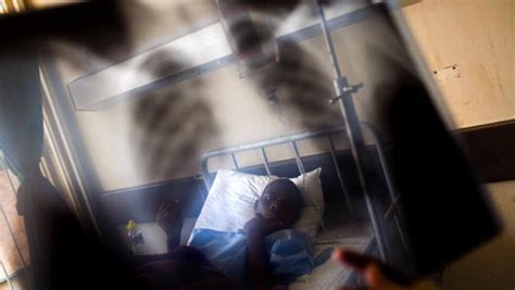 Un Nouveau Plan Mondial Halte à La Tuberculose