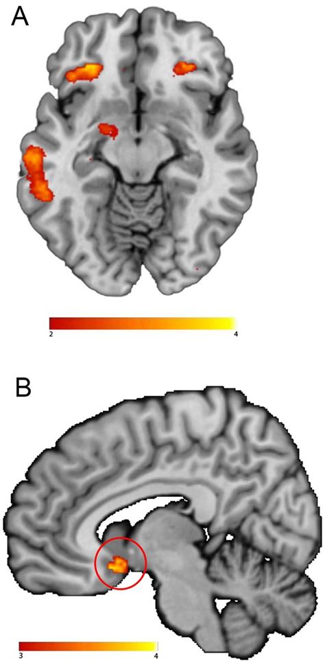 Neural Food Stroop Effect A Main Effect Of The Contrast Of Food Download Scientific Diagram