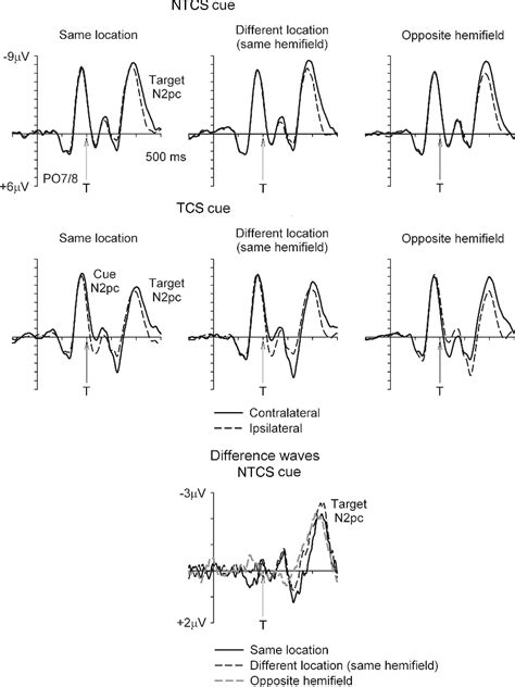 Figure 1 From The Roles Of Feature Specific Task Set And Bottom Up